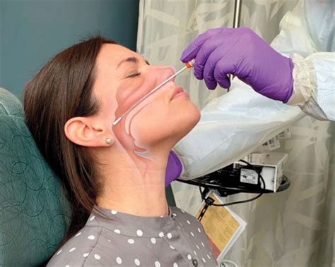 How To Obtain A Nasopharyngeal Swab Specimen