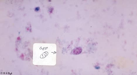 Enteromonas Sp 12 10 