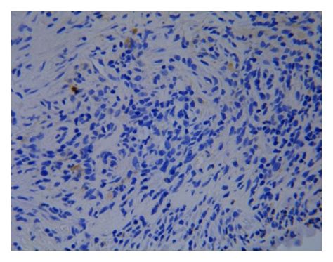 The Expression Of Erα In Ectopic Endometrium Dab Stain ×400 A