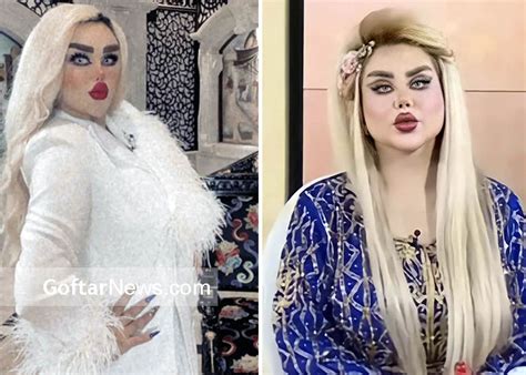Baghdad Born Dalia Naeem 29 Ive Had 43 Cosmetic Procedures Page 4 Goftar News