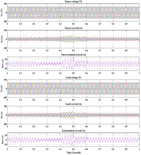 source and load current waveforms of the hospital loads connected to