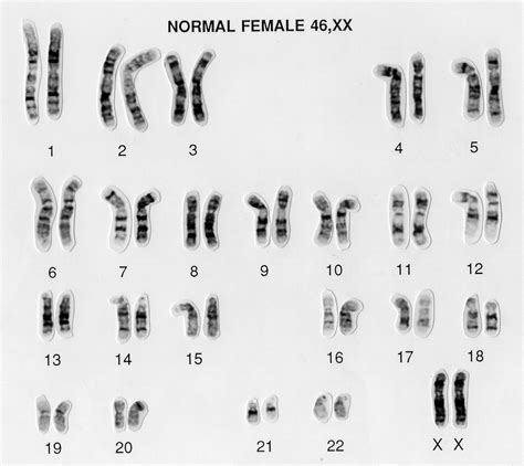 Normal Female 46 Xx Human Karyotype Wellcome Collection