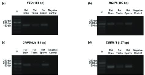 Identification Of Orgs Transcripts In Rats Testes And Sperm By Download Scientific Diagram