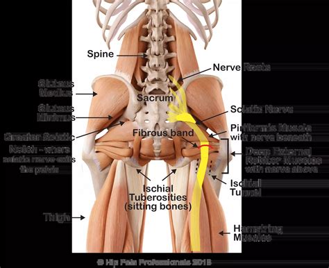 Anatomy Sciatic Nerve Piriformis Syndrome Deep Gluteal Syndrome Sciatica Piriformis Syndrome