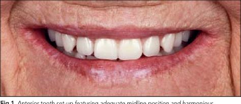 Figure 1 From The Lip Tooth Ridge Classification A Guidepost For