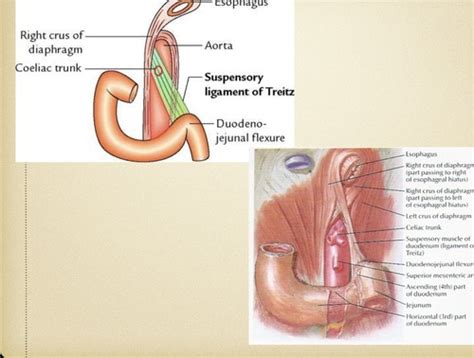 Upper Git Bleeding Flashcards Quizlet Upper Git Bleeding Flashcards Quizlet