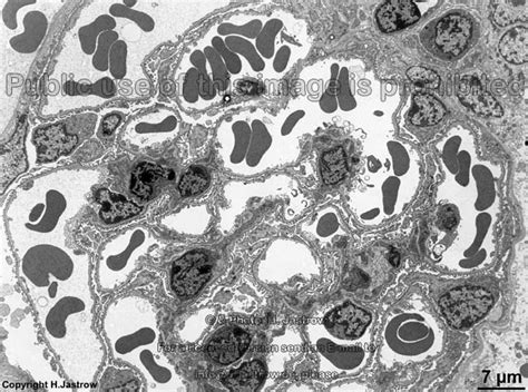 Renal Glomerulum Dr Jastrows Electron Microscopic Atlas