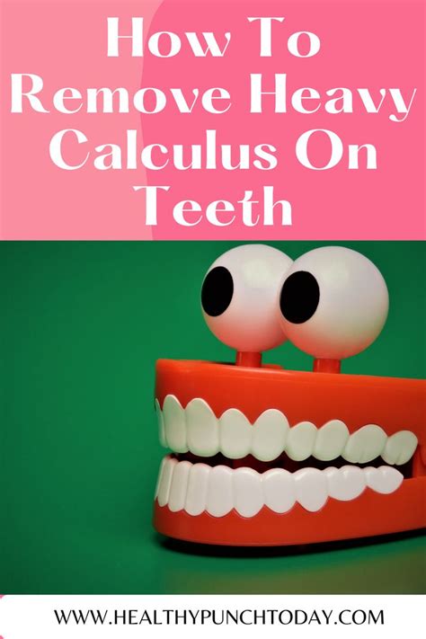Effective Ways To Remove Heavy Calculus On Teeth