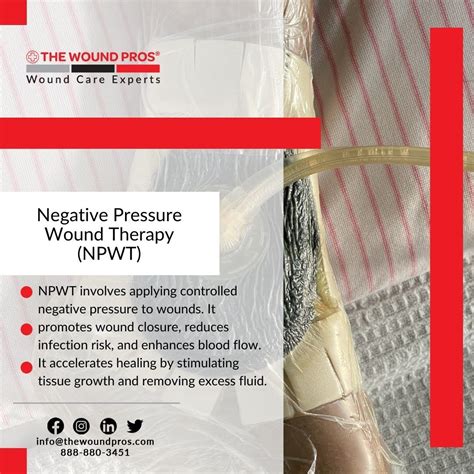 How Npwt Can Help Complex Wounds Wound Pros Management Group Inc