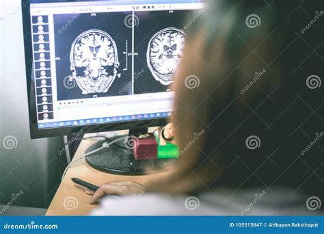 Dementia On Mri Film Brain Dementia Stock Image Image Of Imging
