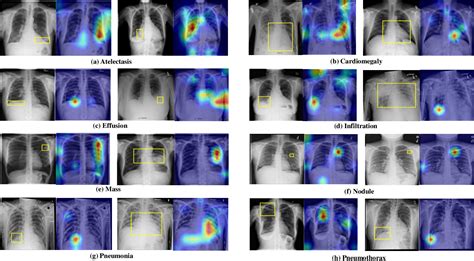 Figure 1 From High Resolution Network With Dynamic Convolution And