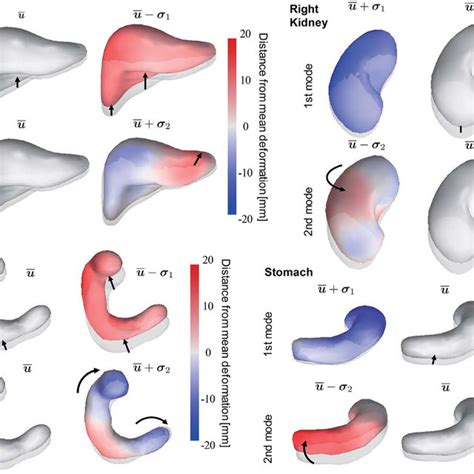 Pdf Statistical Deformation Reconstruction Using Multi Organ Shape