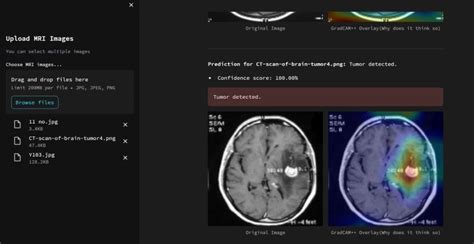 Sukant Aryan On Linkedin Deeplearning Project Learning Datascience Machinelearning