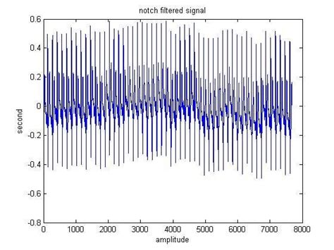 the notch filtered ecg signal download scientific diagram