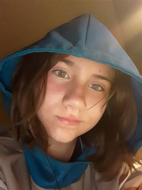 Ticci Toby But With Vitiligo Its 3 Am And Ik Not Going To Get My Mask Just For A Picture