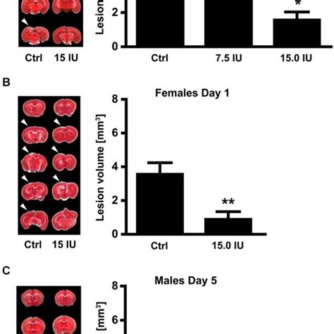 C Inhibitor C Inh Protects Against Traumatic Brain Injury In Mice Download Scientific