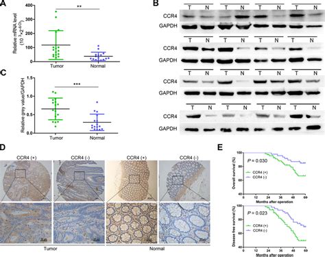 Expression Of Ccr4 And Its Clinical Significance In Crc Patients A