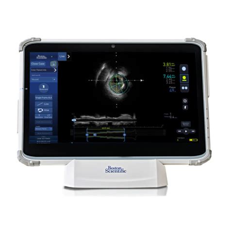 Avvigo™ Multi Modality Guidance System Cardioplus