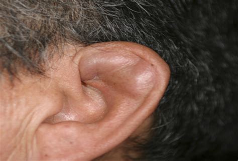 Ultrasound Quarterly