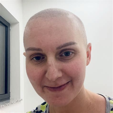 Astrocytoma Grade 4 Астроцитома 4 стадия рак Youtube