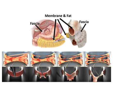 Surgery Simulation Professor Jian Jun Zhang