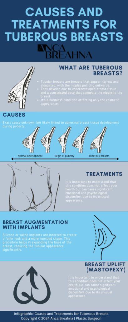 Causes And Treatments For Tuberous Breasts Anca Breahna