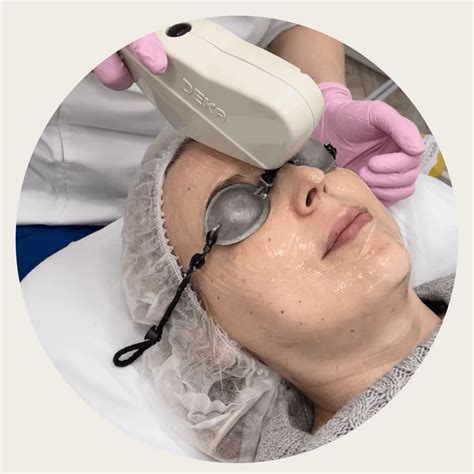 Ipl терапия в Новосибирске цены показания Медицинский центр Аллея красоты