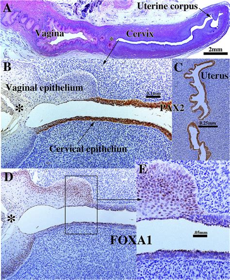 Sagittal Sections Of A 21 Week Female Reproductive Tract A Depicts