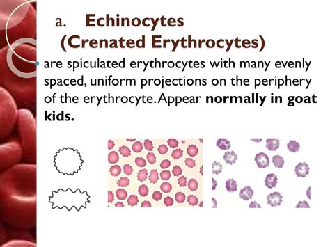 Echinocytes And Crenation