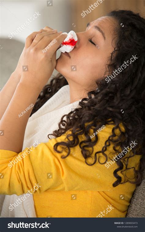 Woman Nosebleed Stock Photo 1289003473 Shutterstock
