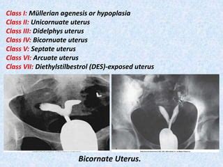 Presentation1 Pptx Radiological Imaging Of Uterine Lesions Pptx