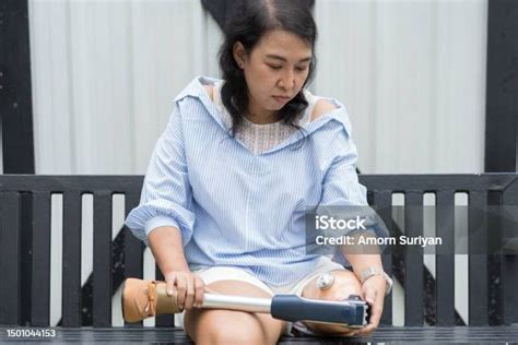 절단 된 여성 의족을 가진 여성이 정원에 야외에 앉아 있다 의족을 가진 여자 핸디캡 야외 다리 보철물 장비를 가진 아시아 여성 35 39세에 대한 스톡 사진 및 기타 이미지