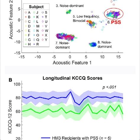 Longitudinal Assessment Of The Pulse Synchronized Sound Pss A