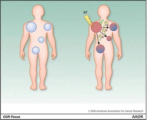 Radiation Effects On Human Body