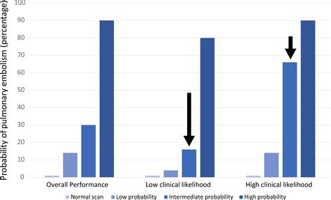 Ventilation Perfusion Scan A Primer For Practicing Radiologists Radiographics