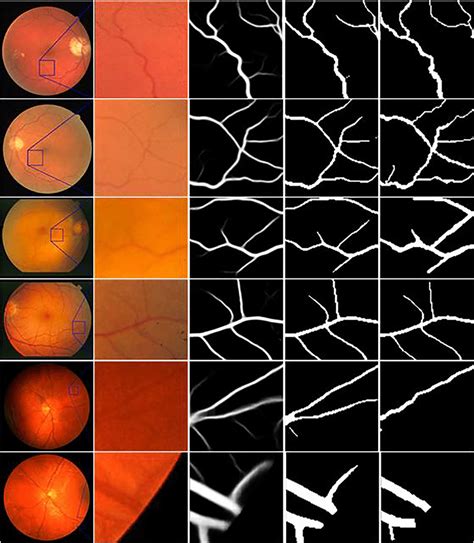 Details Of The Segmentation Result Download Scientific Diagram
