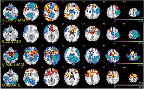 Group Brain Activation Maps Locations Of Group Wise Bold Signals From