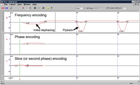 15 gradients applied in the frequency phase and slice encoding