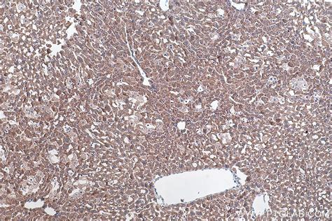 Ihceasy Uso1 Ready To Use Ihc Kit Khc0884 Proteintech