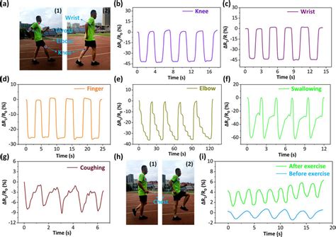 A1 And A2 Photos Of Runners And Pcgm Based Strain Sensor Download Scientific Diagram