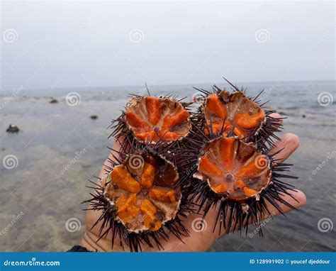 Sea Urchin Sting