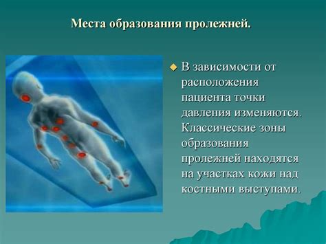 Профилактика пролежней - online presentation