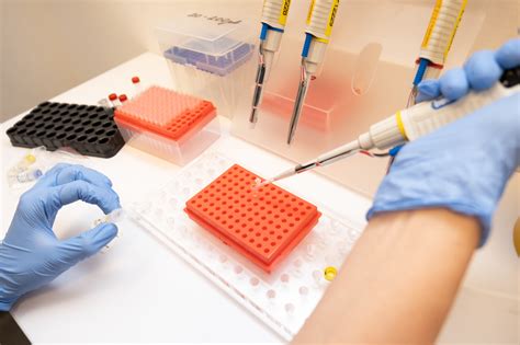 Cel mai larg panel de boli sexual transmisibile depistat printr o singură analiză de laborator