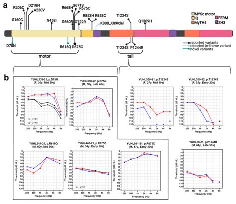 Clinical Heterogeneity Associated With Myo7a Variants Relies On