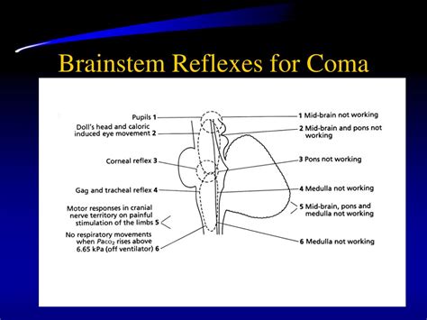 Ppt Coma And Brain Death （昏迷與腦死） Powerpoint Presentation Id945586