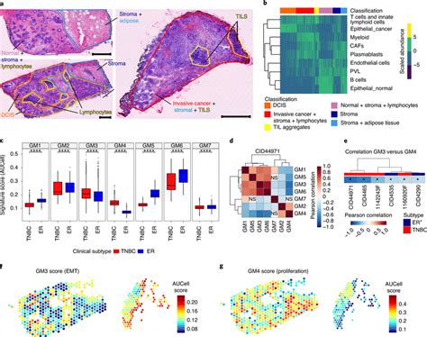 Mapping Breast Cancer Heterogeneity Using Spatially Resolved