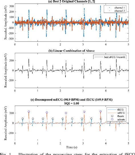 Figure 1 From A Novel Method For The Extraction Of Fetal Ecg Signals From Wearable Devices