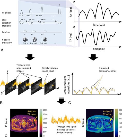 Magnetic Resonance Fingerprinting A Review Of Clinical Appl Investigative Radiology