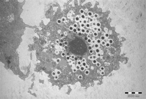 Dont Freak Out But A New Mutant Virus Was Discovered In Contact