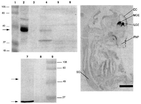 Dlx2 Immunohistochemistry Gene Expression Assay Gxd